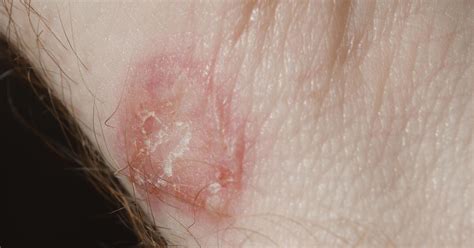 10 Unraveling The Itchy Mystery The Wild Weird And Wacky World Of