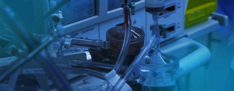 The Angiovac System Angiodynamics