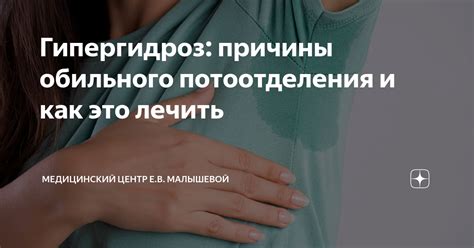 Гипергидроз причины обильного потоотделения и как это лечить Медицинский центр Е В Малышевой