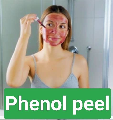 Phenol Peels Smoother Younger Looking Skin With A Phenol Peel