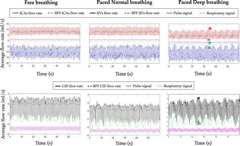 Blood And Cerebrospinal Fluid CSF Flow Rates Aligned With The Download Scientific Diagram