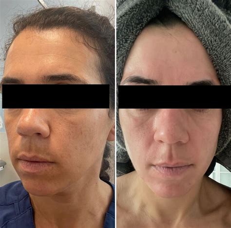 Obagi Medical Grade Skincare Bishops Waltham And Otterbourne Uk