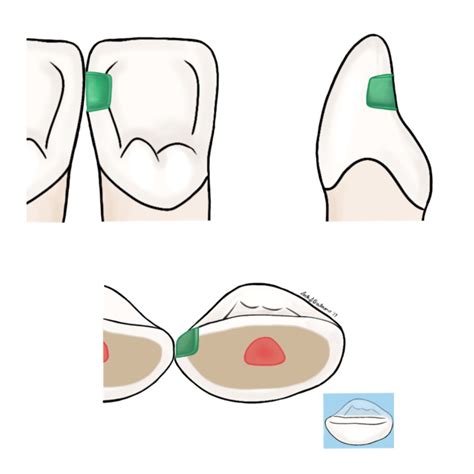 Cdca Adex My Dental Key