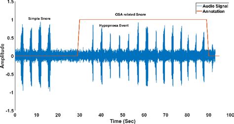 Figure 1 From Automatic Classification Of Osa Related Snoring Signals