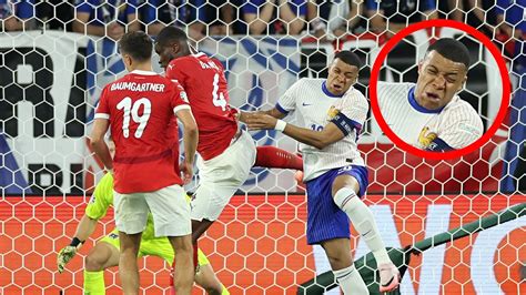 Euro 2024 France Autriche La Blessure Au Nez De Kylian Mbappé En