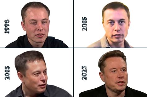 Elon Musks Hair Transformation Trichogenics