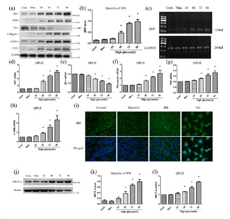 High Glucose Mediated Podocyte Emt And Upregulation Of Srf A Western