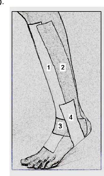 Figure 3 From The Effects Of Kinesio™ Taping On Proprioception At The Ankle Semantic Scholar