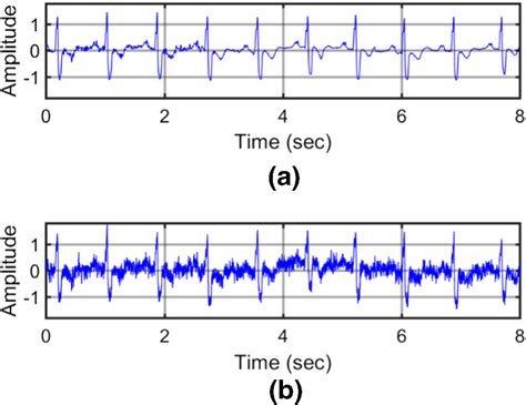Ecg Signals A Original B Noisy At Snr 6 Db Download Scientific Diagram