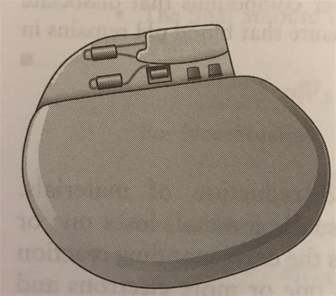 Lithium Iodide Battery The Anode And Cathode