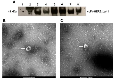 Characterization Of Her2 Specific Hiv 1 Based Vlps Produced With