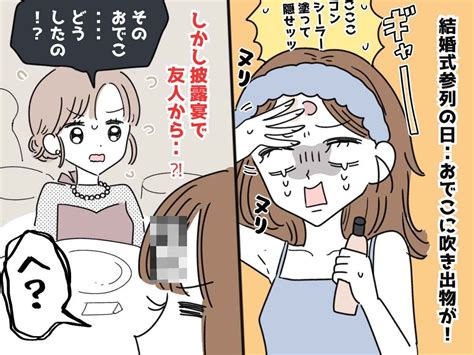 友人「おでこ、どうしたの！？」親友の結婚式の日に【吹き出物】が！「化粧で隠そう♡」→ 最悪の結末に！？ Trill【トリル】