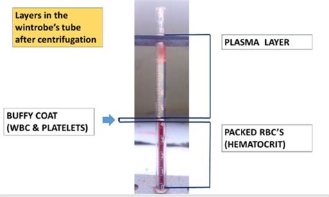HEMA LAB HEMATOCRIT Flashcards Quizlet