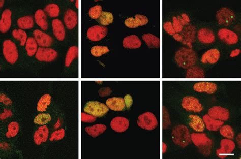Immunofluorescence Analysis Of Subcellular Localization Of P53 Human Download Scientific