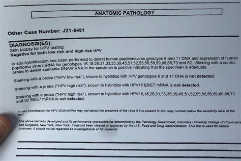 Original Biopsy Said It Might Be Hpv A Year Ago But When I Asked Them To Test For The Strain Of