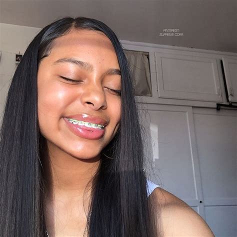 Pinterest Supreme Cora🎭 Light Skin Girls Brace Face Cute Braces