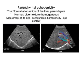 Liver Ultrasound Pptx