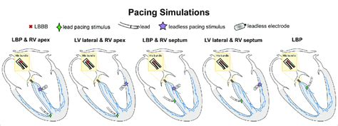 Schematic Representation Of Pacing Simulations The Red Cross Shows The Download Scientific