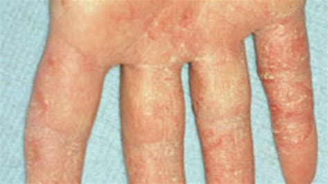 Palms Of Hands In Images