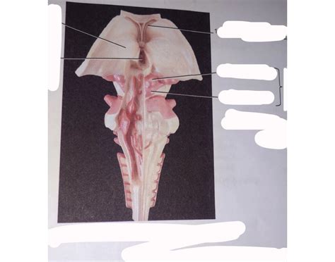 Brain Stem Posterior Model Quiz