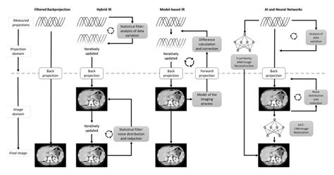 Image Reconstruction In Ct A Filtered Back Projection B