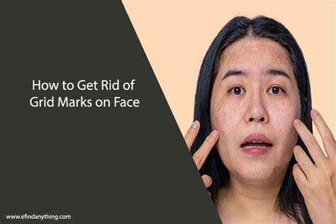 How To Get Rid Of Grid Marks On Face Tips And Tricks