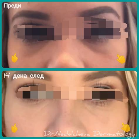 Дерматологичен център Д р Неделчева Home Facebook