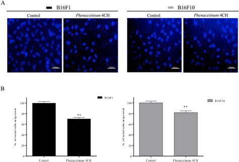 Effect Of Phenacetinum 4CH On Dispersed B16 Cells 3D Migration For 3D