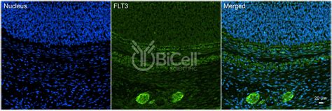 Flt3 Flk2 Or Stk1 Or Cd135 Antibody Bicell Scientific® Flt3 Flk2 Or Stk1 Or Cd135 Antibody Bicell Scientific®