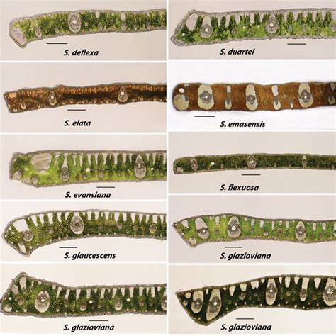 Alphabetically Arranged Marginal Leaflet Transections Syagrus Comosa