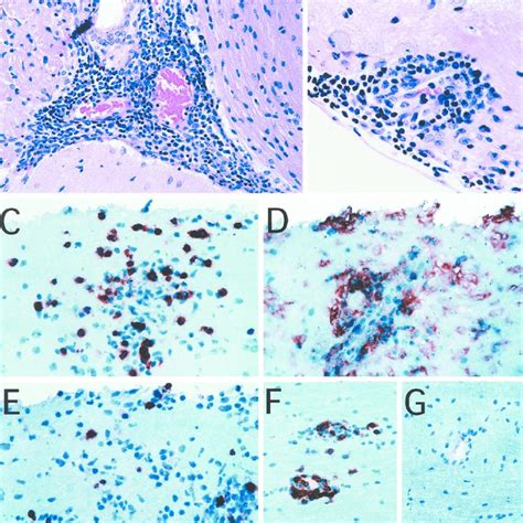T Cell Populations In 2d2 Mog Specific Tcr Transgenic Mice Thymocytes