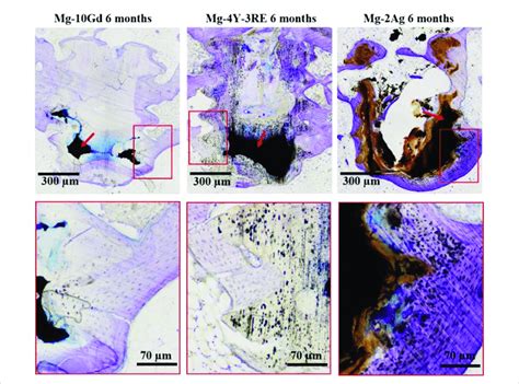 2d Histological Slides Of Mg 10gd Mg 4y 3re And Mg 2ag Stained With