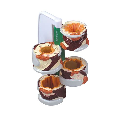 4 Piece Bronchus Model Gpi 3d Anatomy