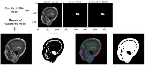 Github Engineer Ayesha Shafique Brain Tumor Segmentation And