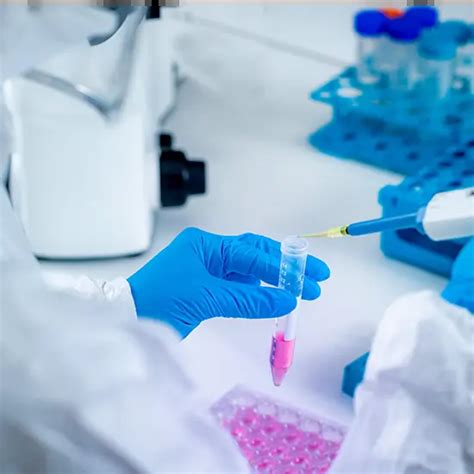 Book Mycoplasma Test Price In Delhi Cost Near Me India Ganesh Diagnostic