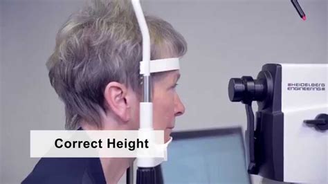 How To Best Practice Pre Exam Preparation With Spectralis Oct Youtube