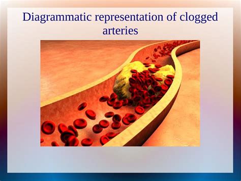 Hyperlipidaemia Causes Symptoms Risk Assessment And Care Plan
