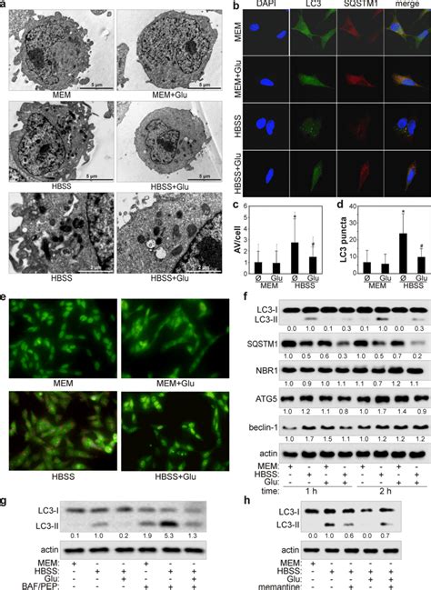 Glutamate Inhibits Starvation Induced Autophagy In Sh Sy5y Cells Af