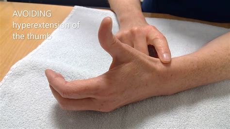 Osteoarthritis Of Carpometacarpal Thumb Joint Youtube