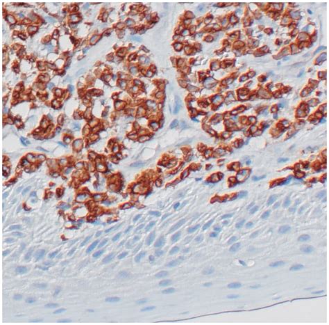 Epredia™ Lab Vision™ Cd79amb 1 B Cell Marker Rabbit Monoclonal