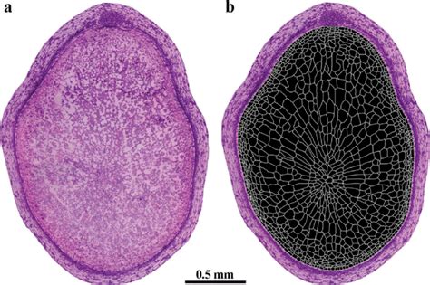 Image Processing Of Whole Section Of Developing Rice Kernel At 7 Daf