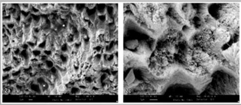 28 Teeth Bleaching Complications Flashcards Quizlet