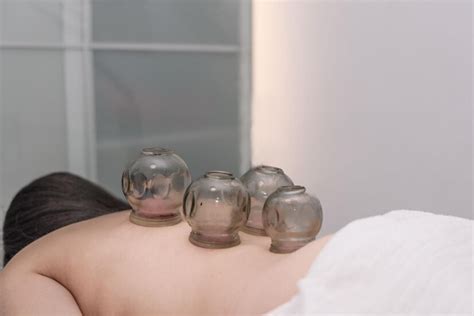 Premium Photo Traditional Chinese Medicine Acupuncture Cupping