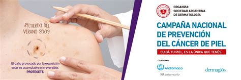 Campaña De Prevención De Cáncer De Piel Acami