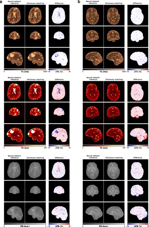 neural network based parameter estimation for a representative patient