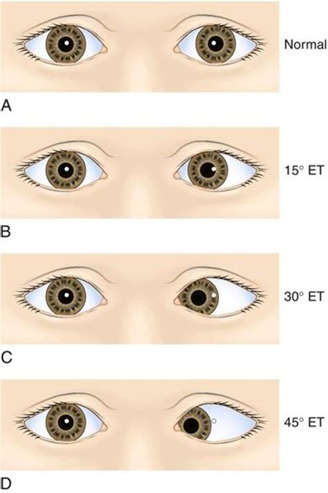 Appendix The Massachusetts Eye And Ear Infirmary Illustrated Manual