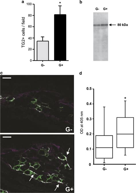 Transglutaminase 2 Tg2 Expression And Colocalisation With Iga Are