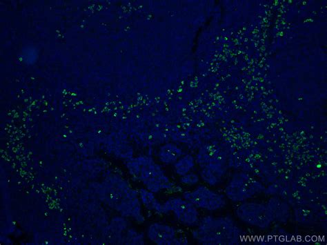 Human Ig Lambda Light Chain Antibody 20758 1 Ap Proteintech 武汉三鹰生物技术有限公司