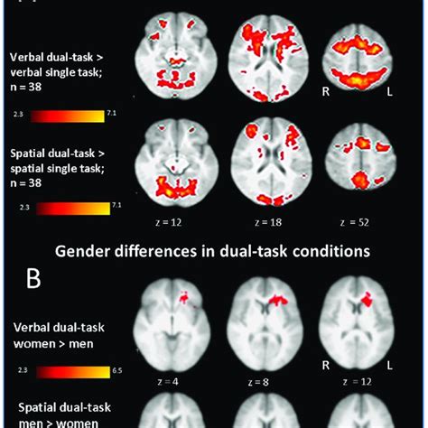 Activation Patterns For All Verbal And Spatial Dual Tasks Compared With