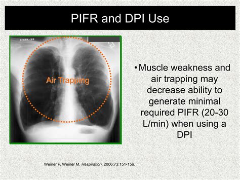 Demystifying Nebulization Jindal Chest Clinic Ppt
